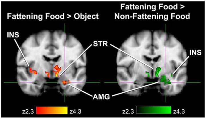 Food, Weight, and your Brain, in Pictures | Paleo Leap