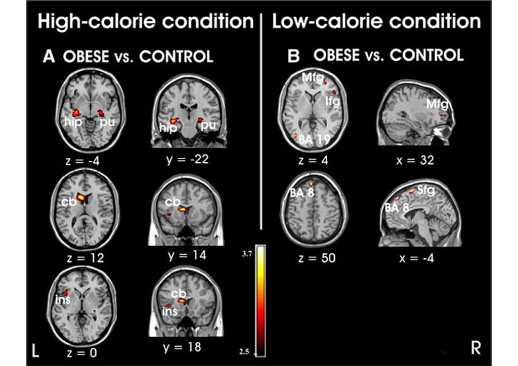 Food, Weight, and your Brain, in Pictures | Paleo Leap