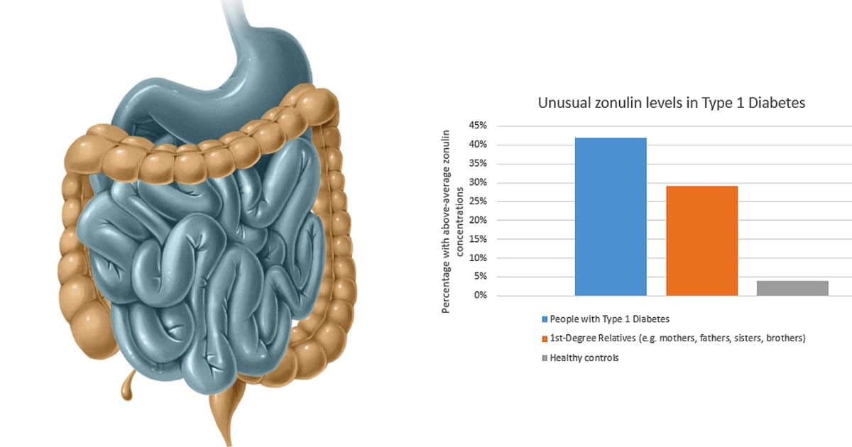 You And Your Gut, in Graphs and Charts | Paleo Leap