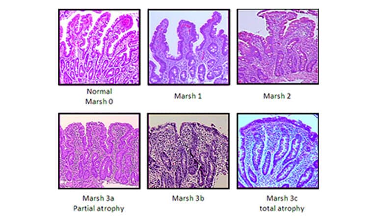 You And Your Gut, in Graphs and Charts | Paleo Leap