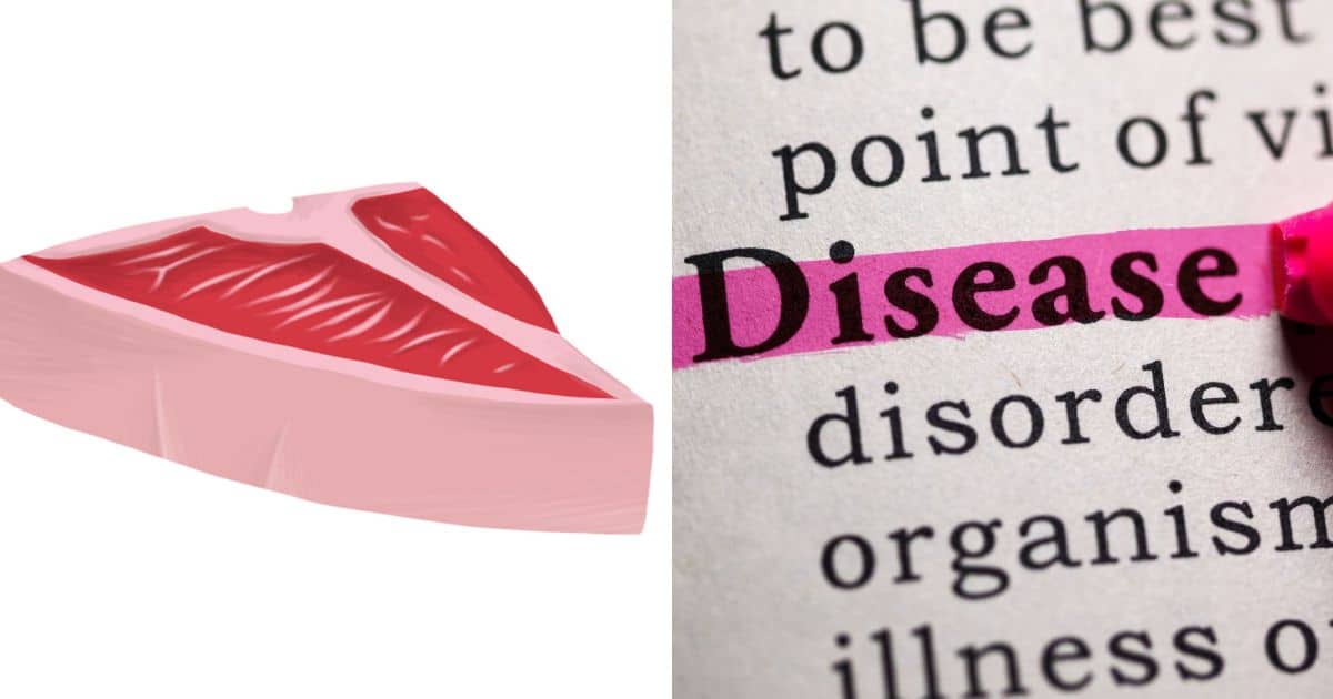 5 Reasons to Relax About Associations Between Red Meat and Disease ...